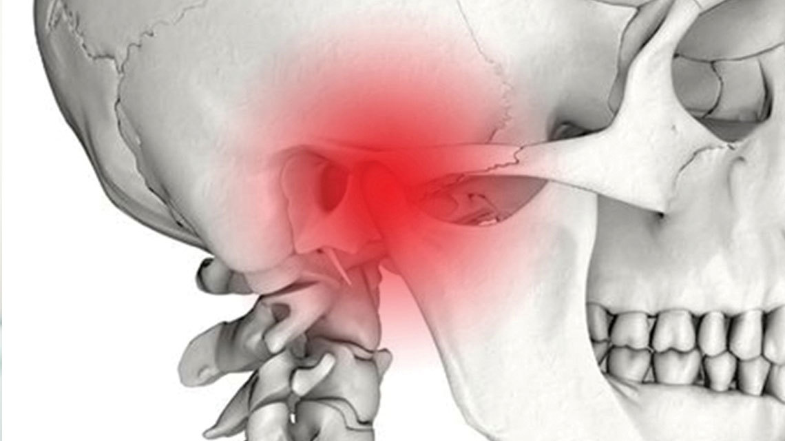 Why does my jaw hurt? : TMJ pain explained | Tempromandibular Pain (TMJ ... Why does my jaw hurt? : TMJ pain explained | Tempromandibular Pain (TMJ ...